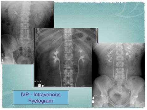 Ppt Exploring The Urinary System Functions Structure And Processes