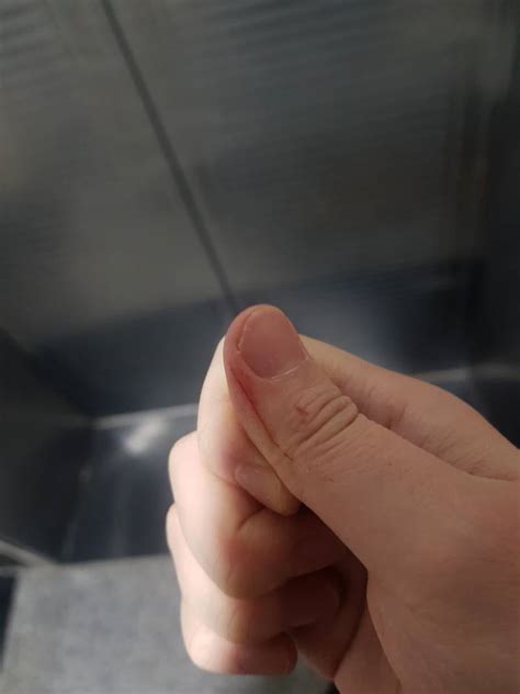 [잡담] 알바 바쁜데 고무장갑도 못끼고 알바해서 손 이래됐었어 인스티즈 Instiz 일상 카테고리