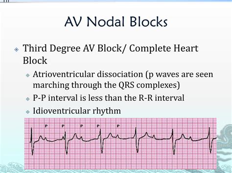 Ppt Heart Blocks Powerpoint Presentation Free Download Id2777927