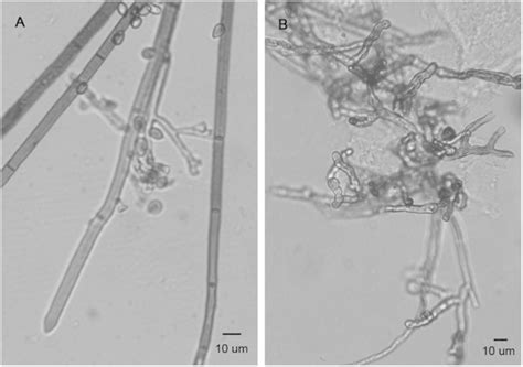 Microscopic Observation Of Hyphal Morphology Of A B Cinerea From The