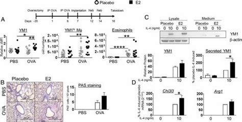Estrogen Signaling Contributes To Sex Differences In Macrophage