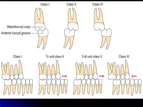 Classification Of Normal Occlusion And Malocclusion Ppt