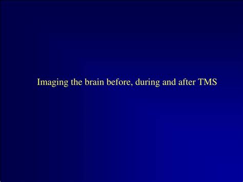PPT Imaging The Brain Before During And After TMS PowerPoint Presentation ID 3033961