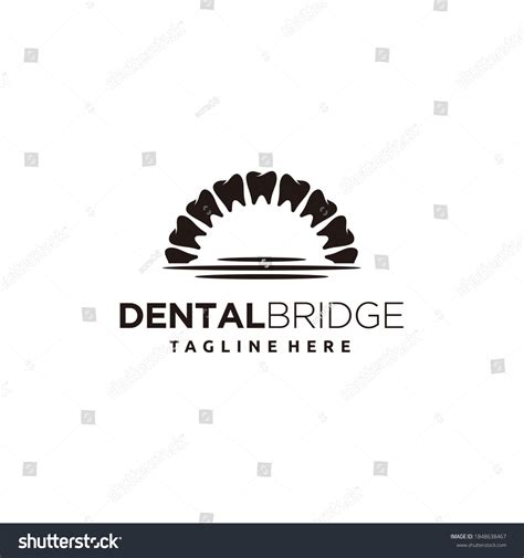 Denta Simple Canal Waterway Bridge Stone Stock Vector Royalty Free