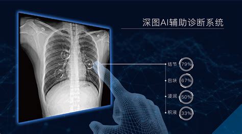 Ai智能辅助诊断系统