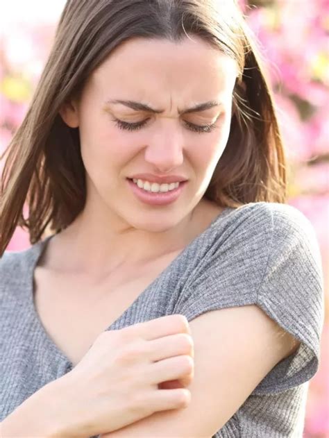 9 Tips To Avoid Mosquito Bites In This Rainy Season Tradeindia