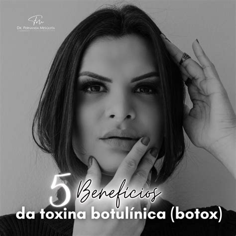 Portal Arcos Você sabia que o botox possui inúmeros benefícios para a nossa saúde o que