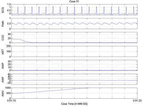 Case 31 Waveform Plots 10 Second Plots