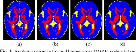 Figure 1 From Segmentation Of Infant Brain Mr Images Based On Adaptive