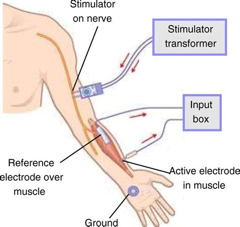 Recording Emg Signals Using Electrodes Attached On The Muscle Surface