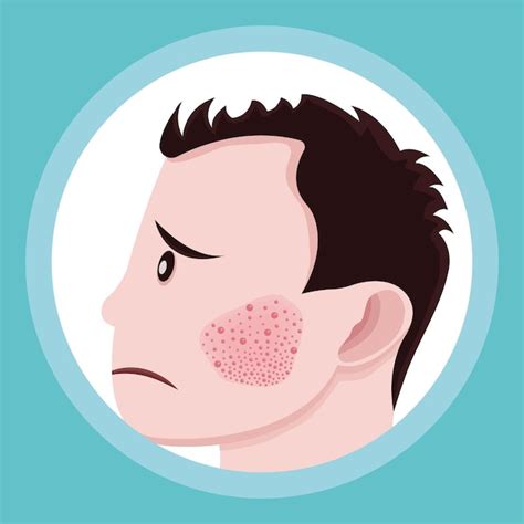 Premium Vector Person With Acne On The Face
