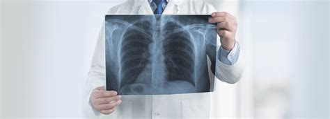 Fibrosis Pulmonar Idiopática el gran desafío del diagnóstico temprano
