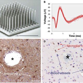 PDF Acute Human Brain Responses To Intracortical Microelectrode Arrays Challenges And Future
