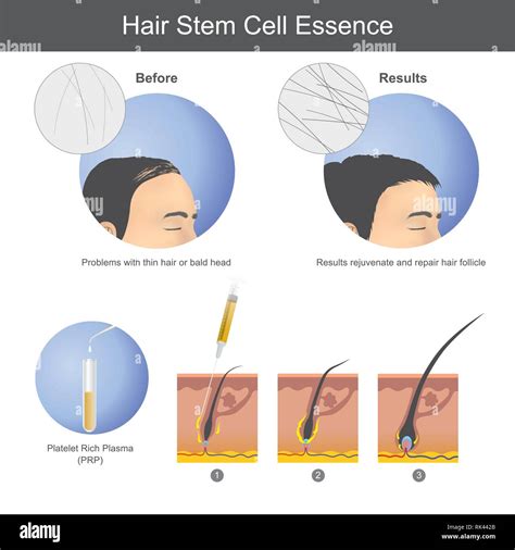 Hair Root