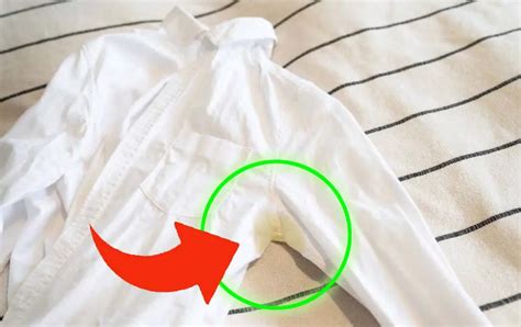 Camisas blancas así se quitan las manchas amarillas debajo de las axilas Solo se necesita una
