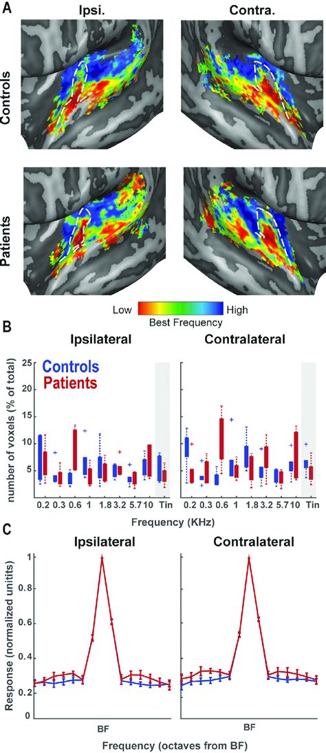 Tonotopy And Tuning Curves In The Auditory Cortex A Tonotopic Map In Tonotopy And Tuning Curves In The Auditory Cortex A Tonotopic Map In