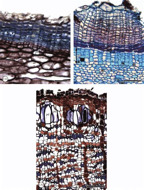 3 Phelloderm Thickness Transverse Sections 131 Thin Phelloderm