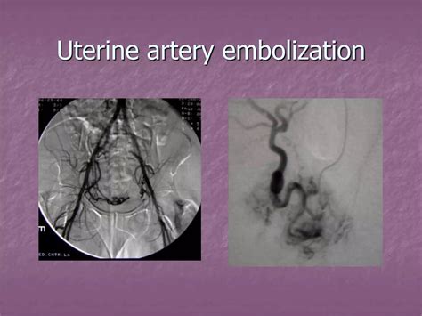Introduction To Interventional Radiology Pptx