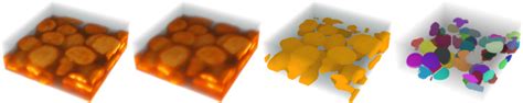Image3d Image Segmentation And Object Separation In 3D Using