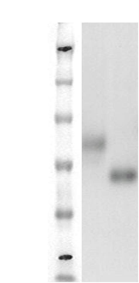 Discoverx Pathhunter Express Gpr27 Cho K1 Arrestin Orphan Gpcr Assay 1