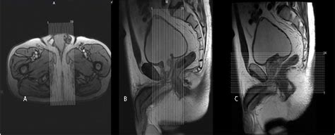 A Comprehensive Guide In Prostate Mr Imaging Providing An Overview Of