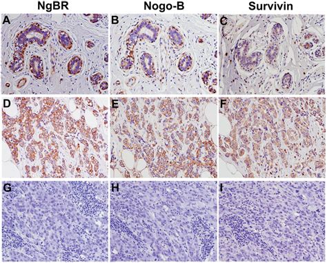 Immunohistochemical IHC Staining Of NgBR Nogo B And Survivin In