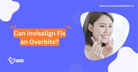 Can Invisalign Fix An Overbite Enhance Dental Ca