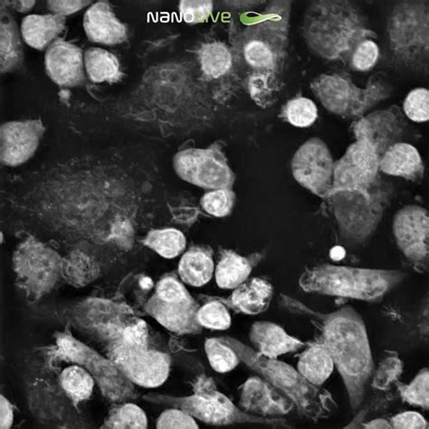 Patricia Ciller On Linkedin Immunooncology Cancerresearch