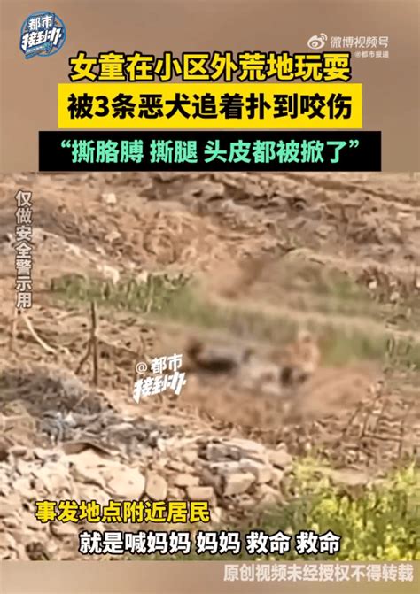 【热议】4岁女童被野狗咬伤；男子校内虐杀流浪猫；流浪动物争议何时休？问题宠物中国