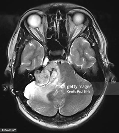 Ear Nose Throat Diagram Photos And Premium High Res Pictures Getty Images