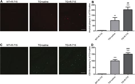 R 715 Increased Amyloid Plaque Burden And CD11b Expression Marker For
