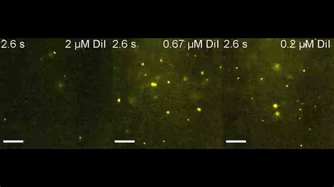 Fluorescent Labeling Of Extracellular Vesicles Youtube