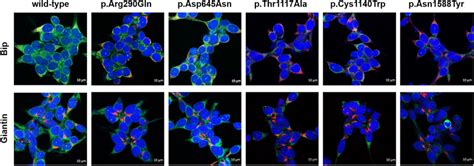 Effect Of Abca4 Variants On Subcellular Localization After Download Scientific Diagram