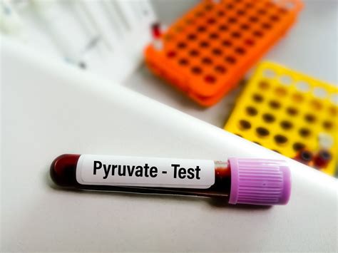 Pyruvate