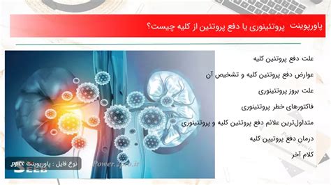 دانلود پاورپوینت پروتئینوری یا دفع پروتئین از کلیه چه چیزی است ؟ کد106356