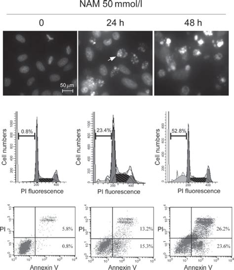 Indications Of Nam Induced Apoptosis In Mcf 7 Cells All Occurred In A