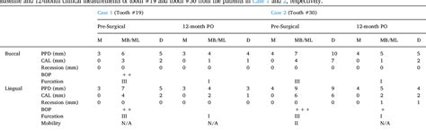 Figure 1 From Treatment Of Mandibular Grade Iii Furcation Involvement Using Platelet Rich Fibrin