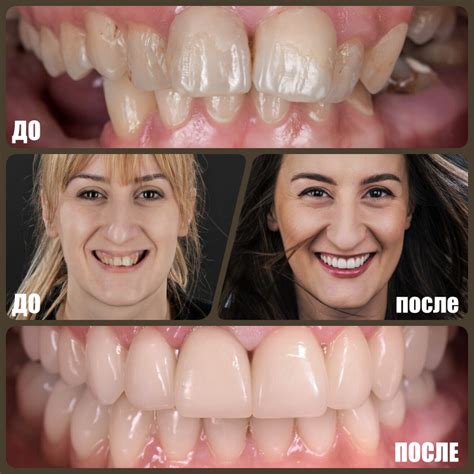 Клинический случай