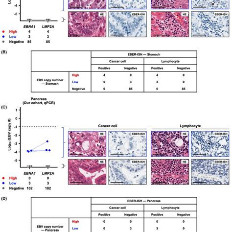 EBV Copy Number Analysis For Gastric Cancer GC And Pancreatic Cancer