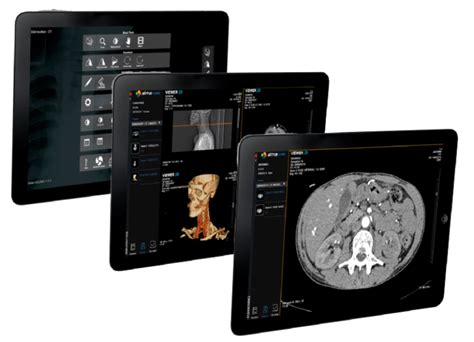 Dicomdata Integrated Dicom Solution