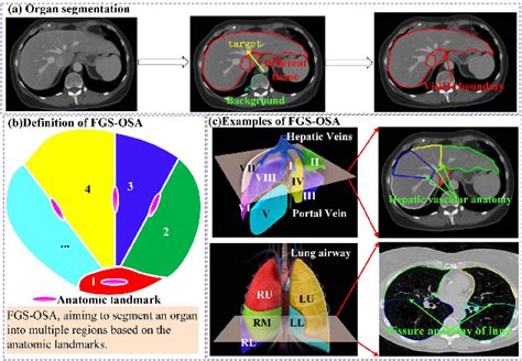 Figure 1 From Arr Gcn Anatomy Relation Reasoning Graph Convolutional