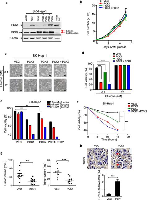 Pck1 Promotes Liver Cancer Cell Death After Glucose Starvation A