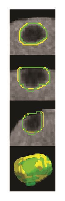 Segmentation Results Obtained By The Proposed Method Compared To Ground Download Scientific