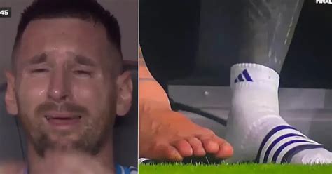 Messi Subit Une Blessure Horrible Lors De La Finale De La Copa America