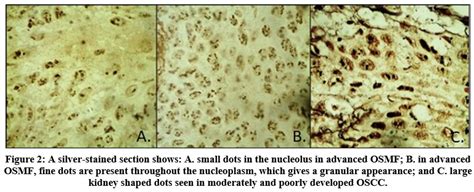 Prognostic Potential Of Argyrophillic Nucleolar Organizer Regions