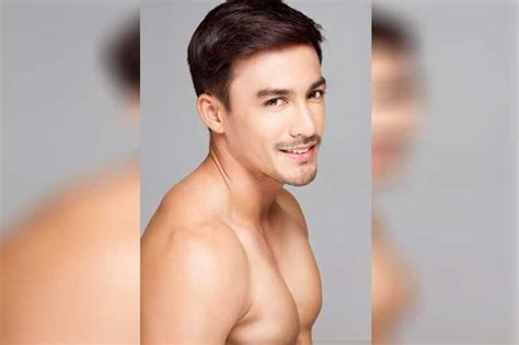 Matapos Maaksidente Sa Motor Mr International Nagkaroon Ng Amnesia