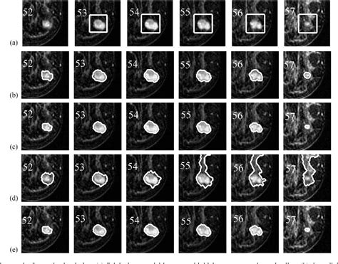 Figure 3 From A New Background Distribution Based Active Contour Model For Three Dimensional