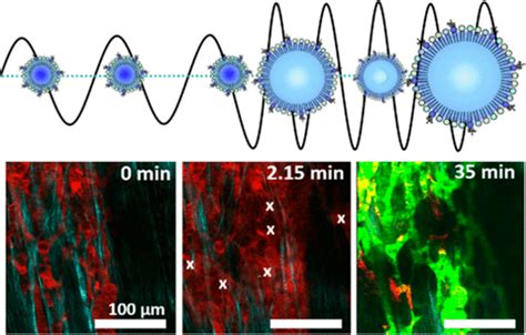 Synchronous Intravital Imaging And Cavitation Monitoring Of Antivascular Focused Ultrasound In