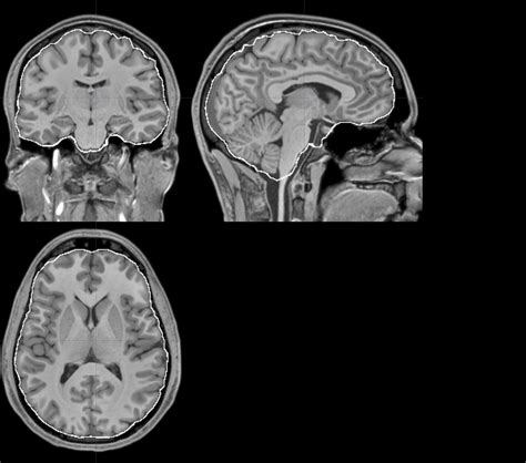 How To Use Fsl Brain Extraction Selective Sapience Medium