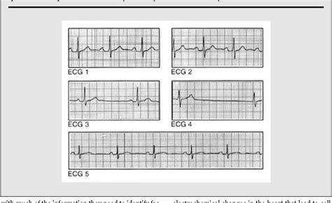 Figure 1 From Preventing Lithium Intoxication Guide For Physicians